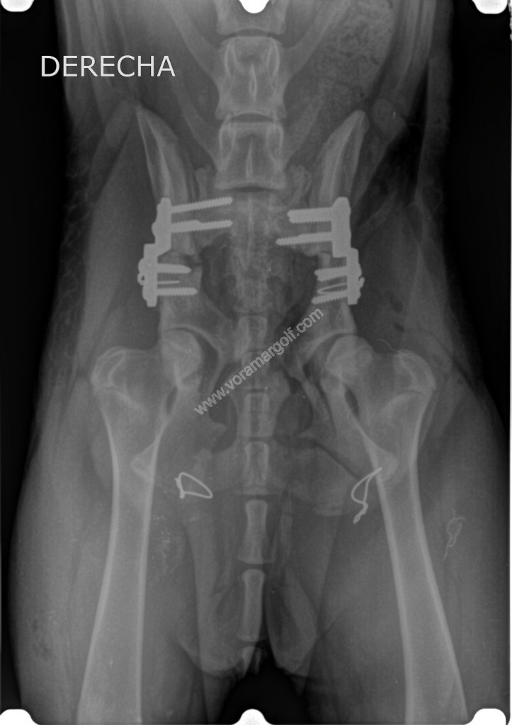 RADIOGRAFIA. Resolución quirúrgica del caso anterior. Tripe osteotomía ...
