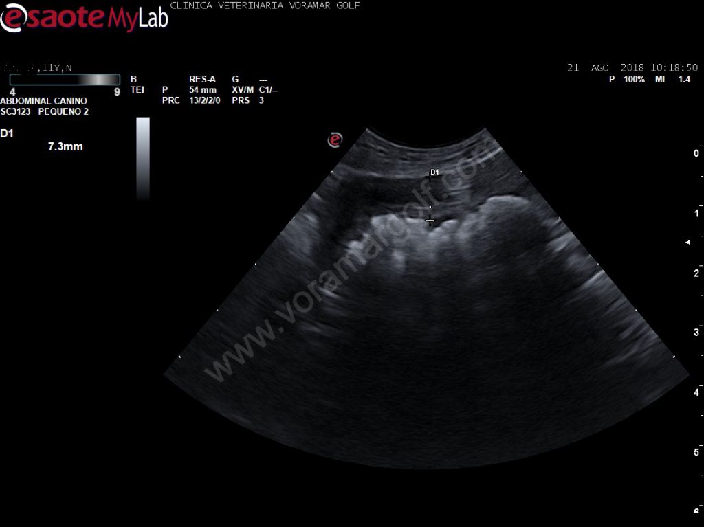 Imagen ecografica de urolitos y del engrosamiento de la pared de la vejiga.